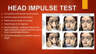Vestibular Apparatus and Examination | PPT