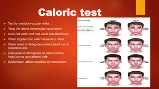 Vestibular Apparatus and Examination | PPT