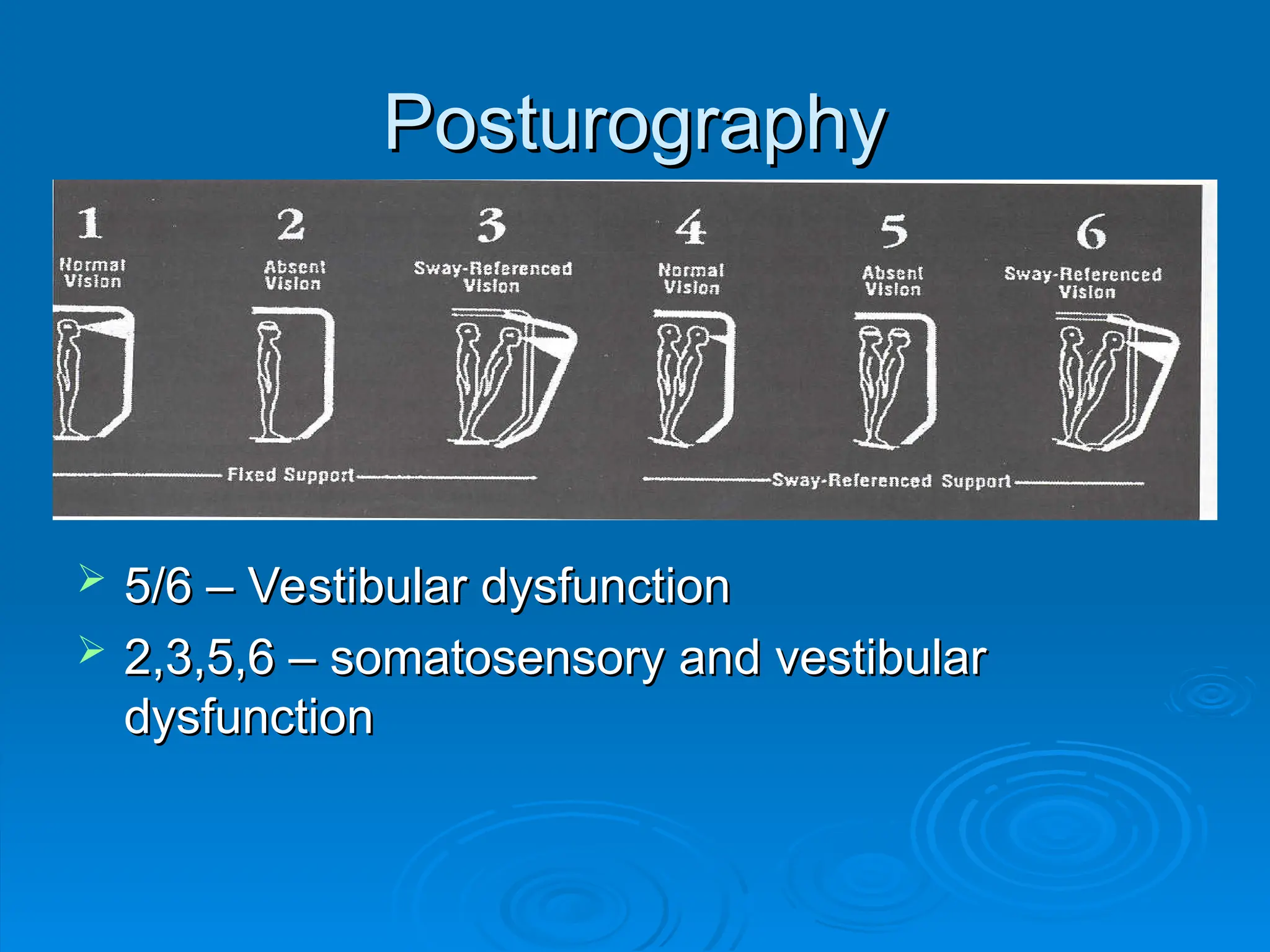 Vestibular F TEST for vestibular Function | PPT