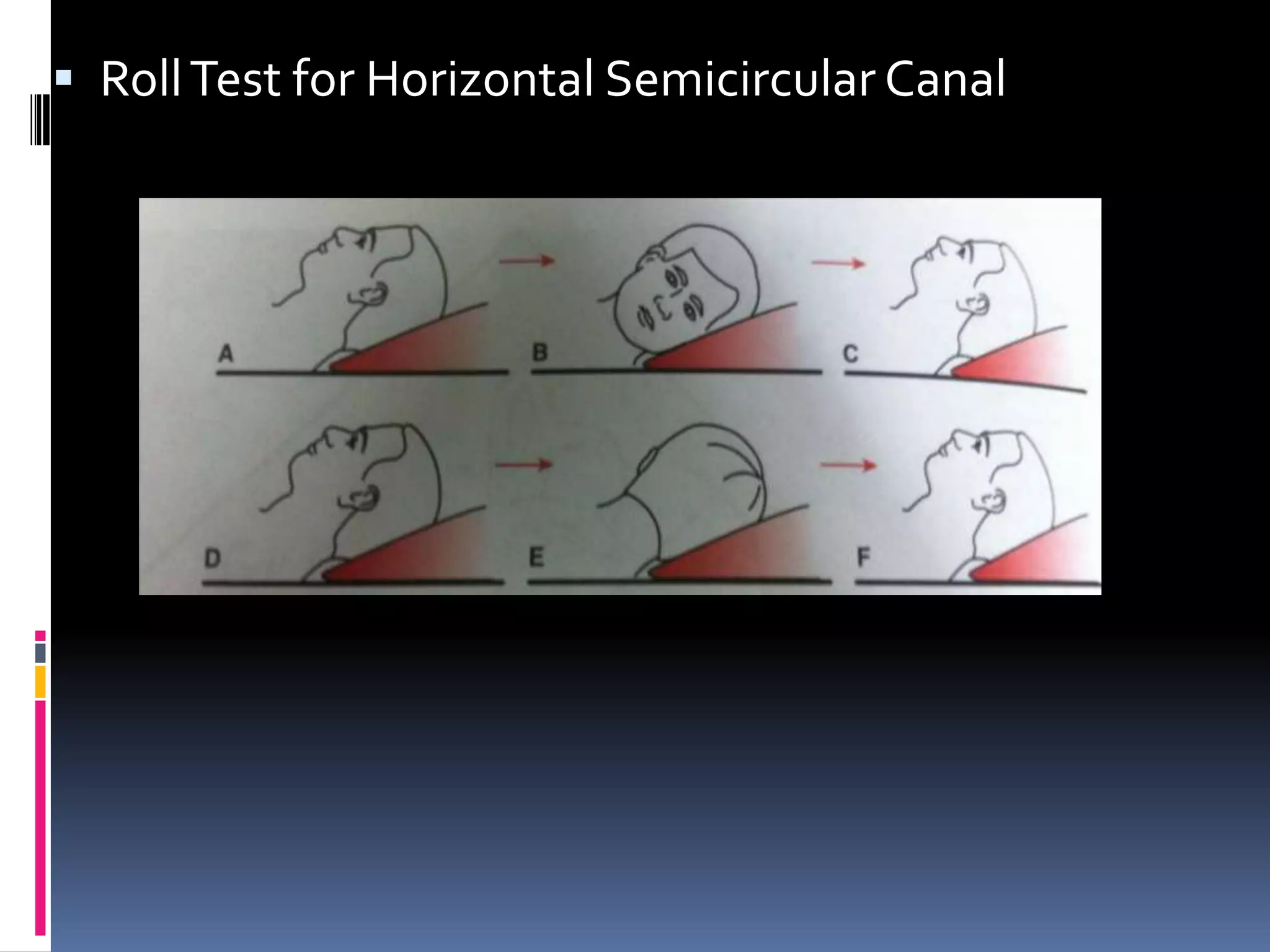 Vestibular function test and its clinical examination | PPTX