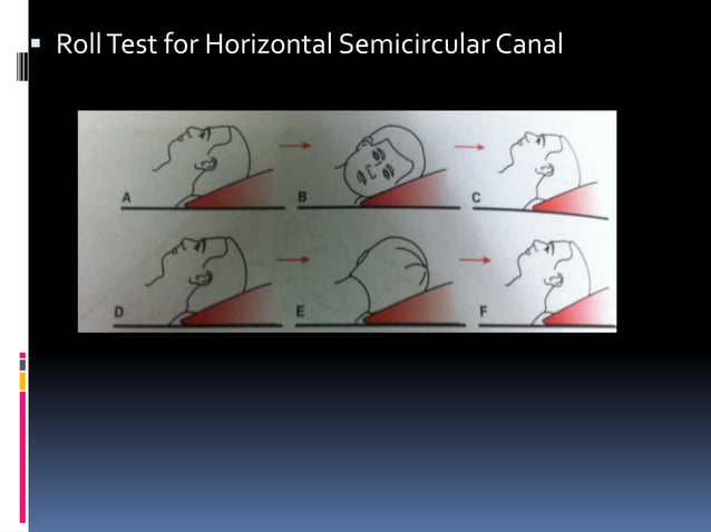 Vestibular function test and its clinical examination | PPTX