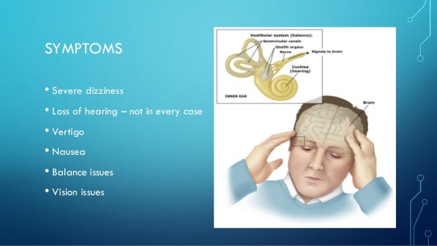 Vestibular Neuritis Symptoms And Treatments Mdhealthcom