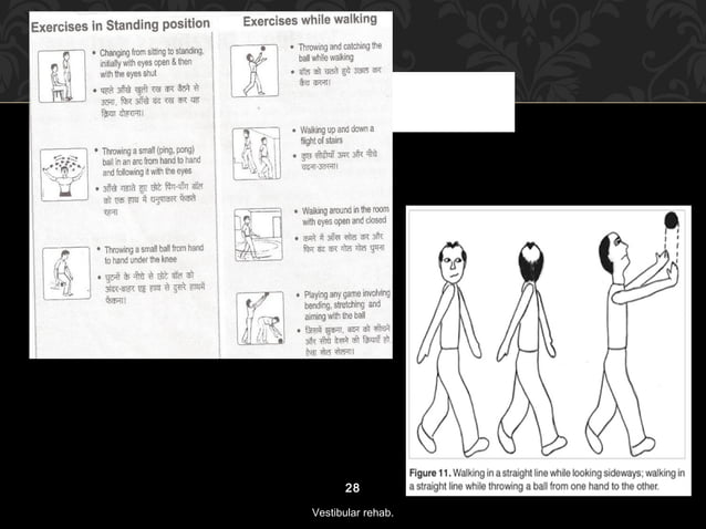 Vestibular rehabilitation | PPT