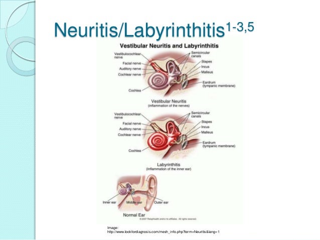 Vestibular Rehabilitation Inservice