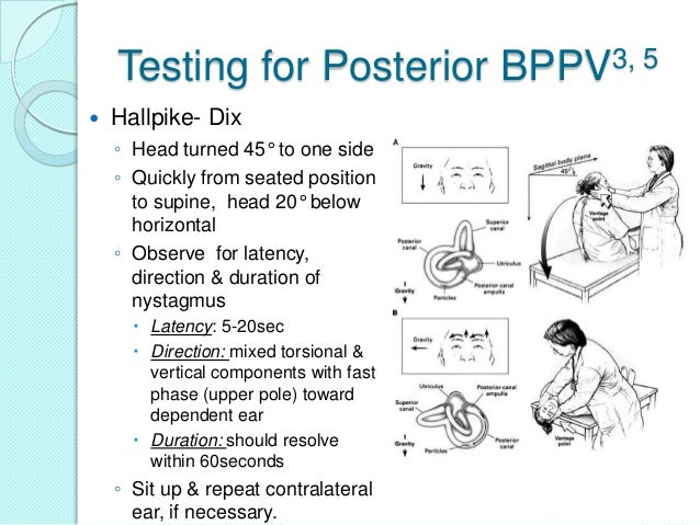 Vestibular Rehabilitation Inservice