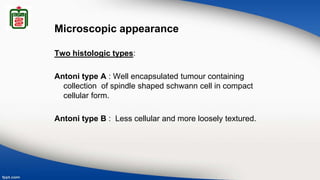 Vestibular Schwannoma.inal.ppt