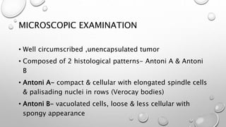 VESTIBULAR SCHWANNOMA for Undergraduates | PPTX