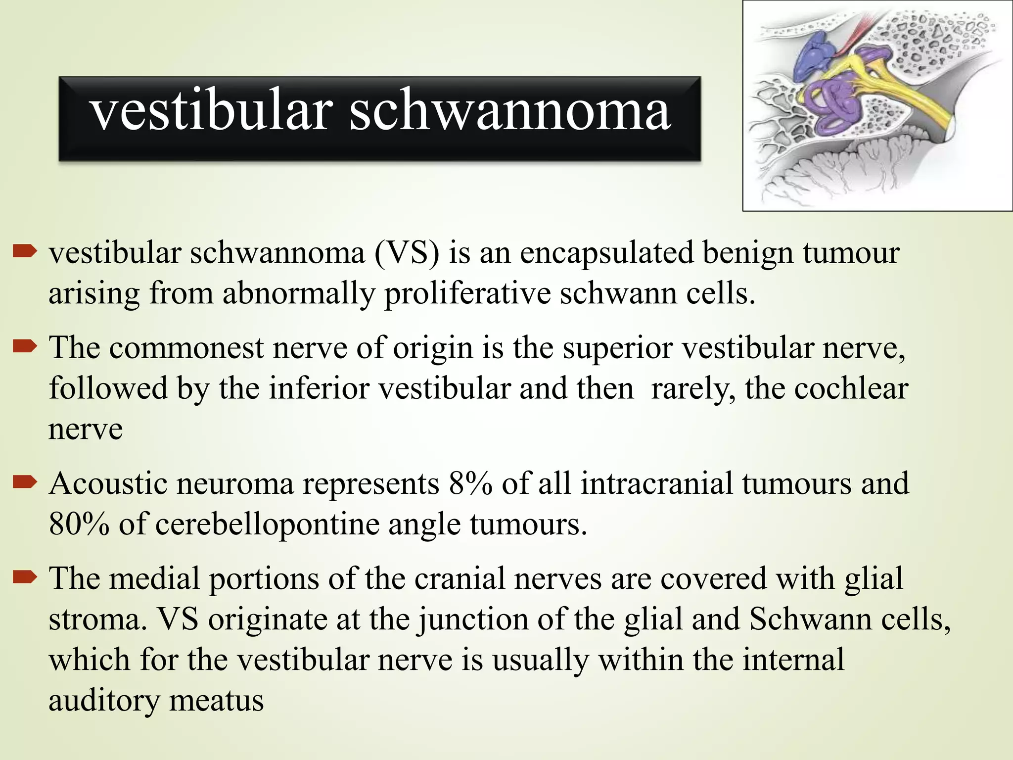 Vestibular schwanoma | PPTX