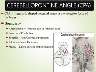 Vestibular schwanoma | PPTX