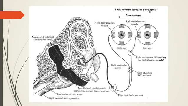 Vestibular system -Maintenance of Balance and Equilibrium | PPTX ...