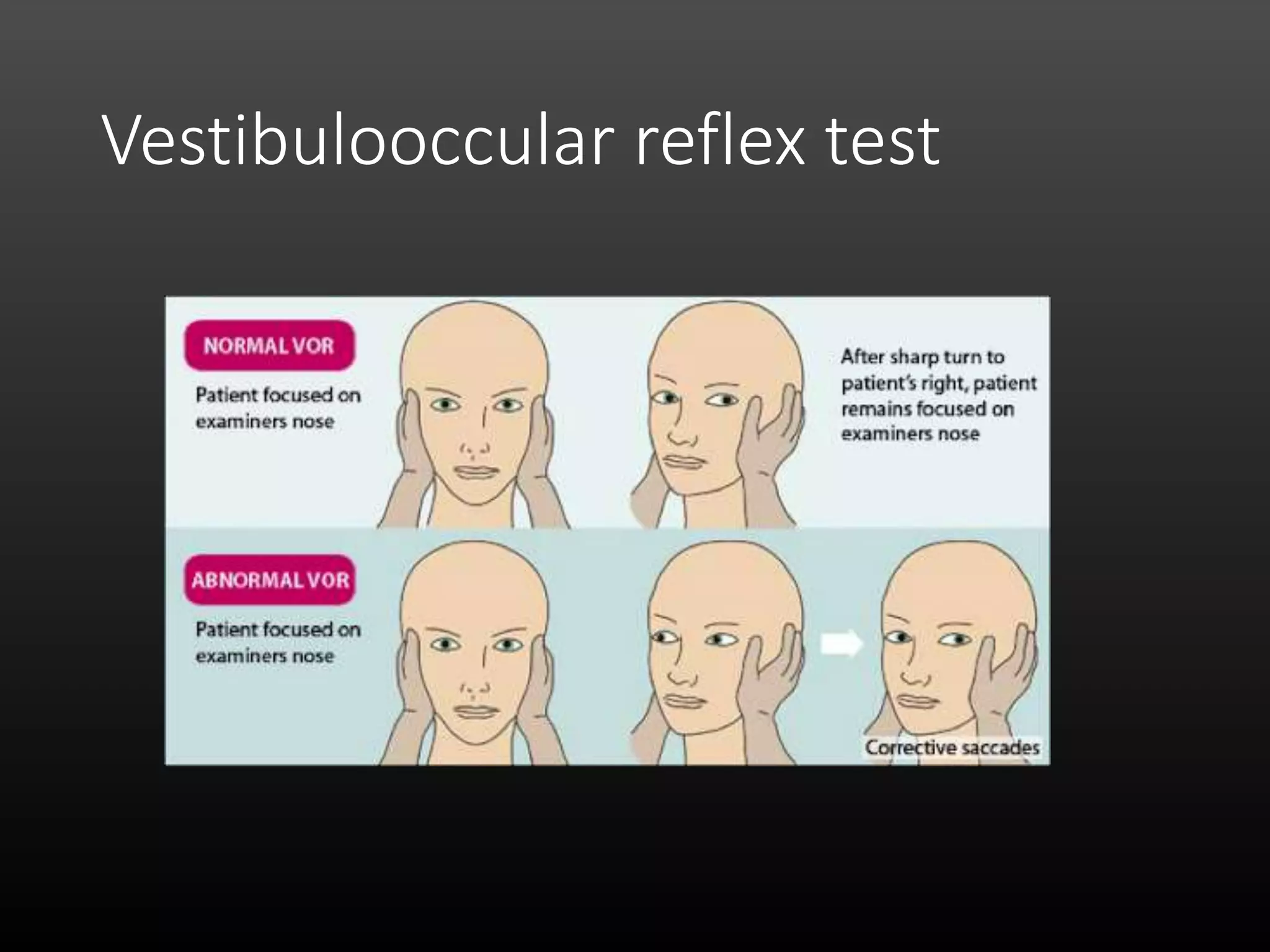 Vestibular system | PPTX