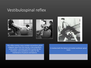 Vestibular system | PPT