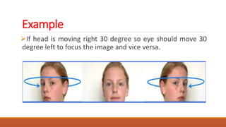 Vestibulo Ocular Reflex Mode Biomedelingl.pptx