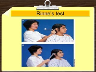 vestibulocochlearnerve8-160906100316.pdf