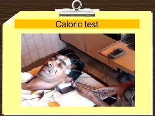 Vestibulocochlear nerve 8 | PPTX