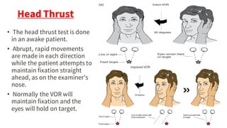 vestibulocochlear nerve dr roop.pdf
