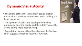 vestibulocochlear nerve dr roop.pdf