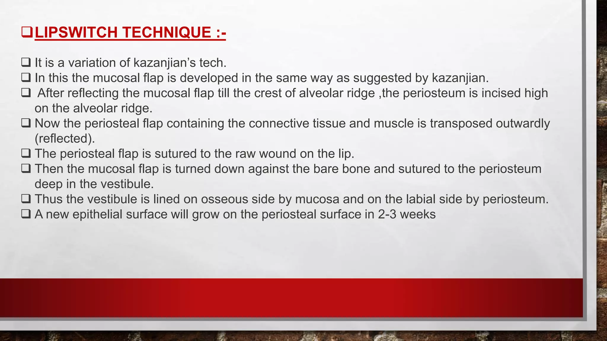 Vestibuloplasty | PPTX