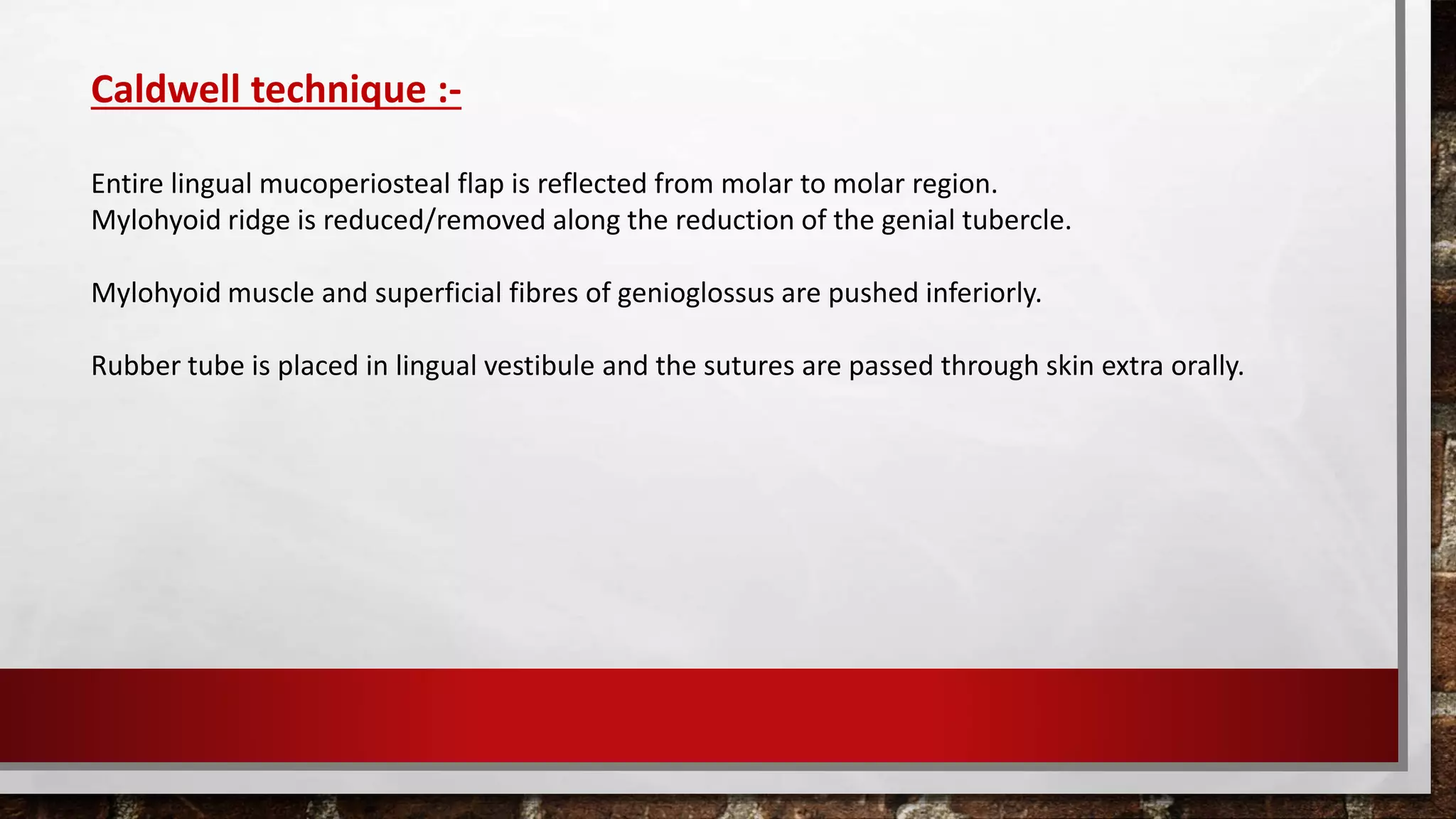 Vestibuloplasty | PPTX