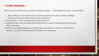 Vestibuloplasty | PPTX