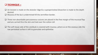 Vestibuloplasty | PPTX