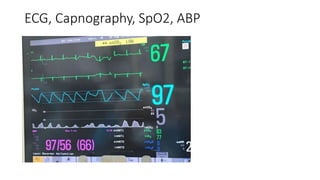 Veterinary Anesthetics Machine and Acessories.pptx