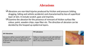 Veterolegal aspects of wounds, burns and scars.pptx