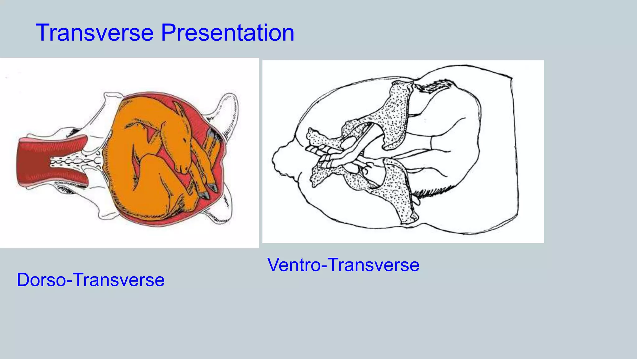 Vet obst lecture 7 Causes of dystocia in farm animals | PPTX