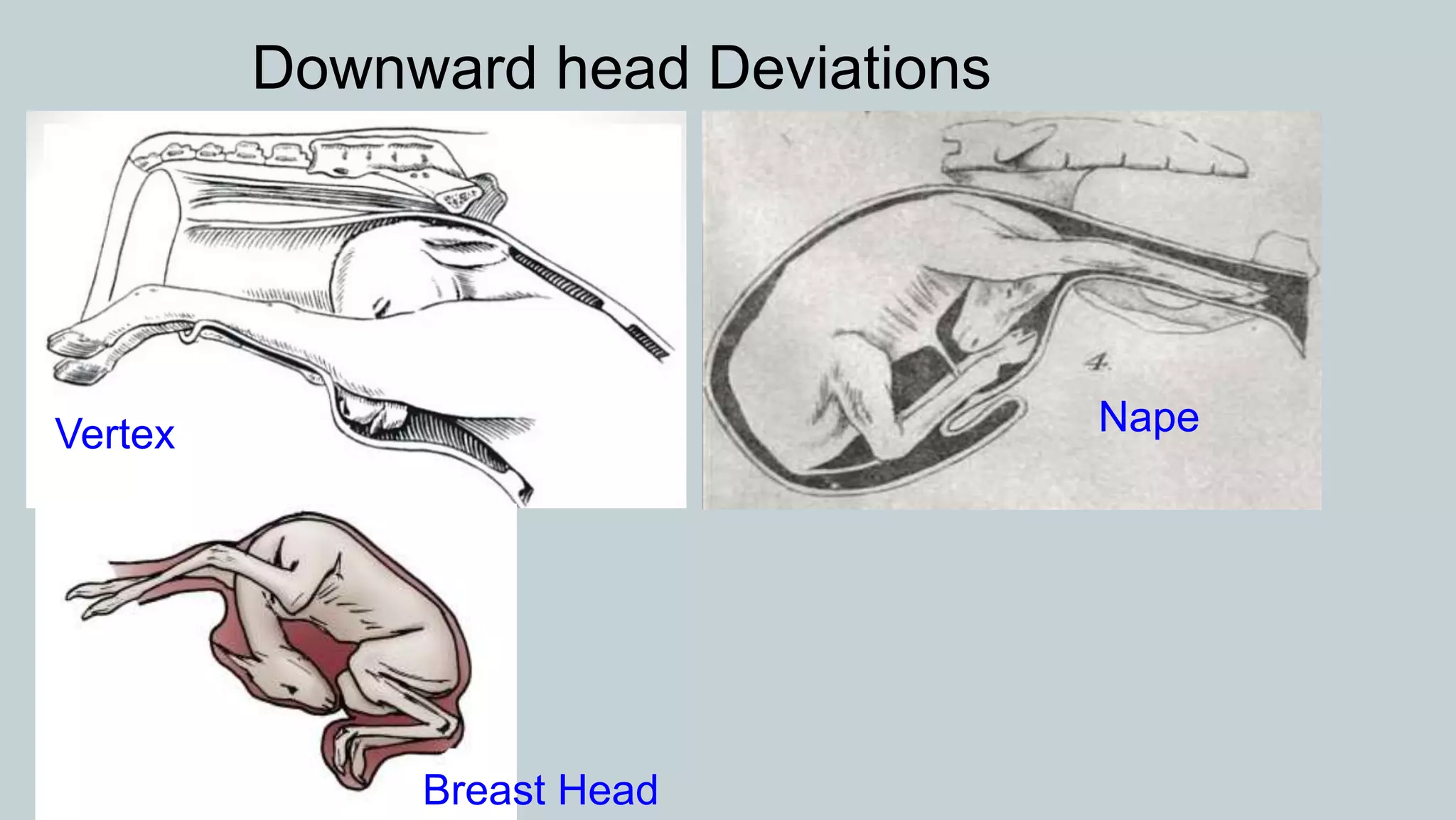 Vet obst lecture 7 Causes of dystocia in farm animals | PPTX
