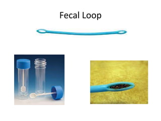 Fecal Loop