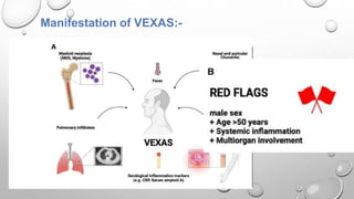 VEXAS syndromes , a diagnostic Puzzlepptx | PPTX