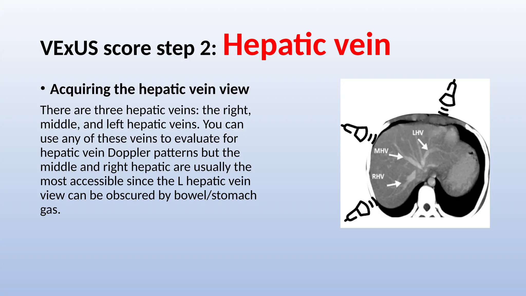 Venous Excess Ultrasound Score For venous congestion | PPTX