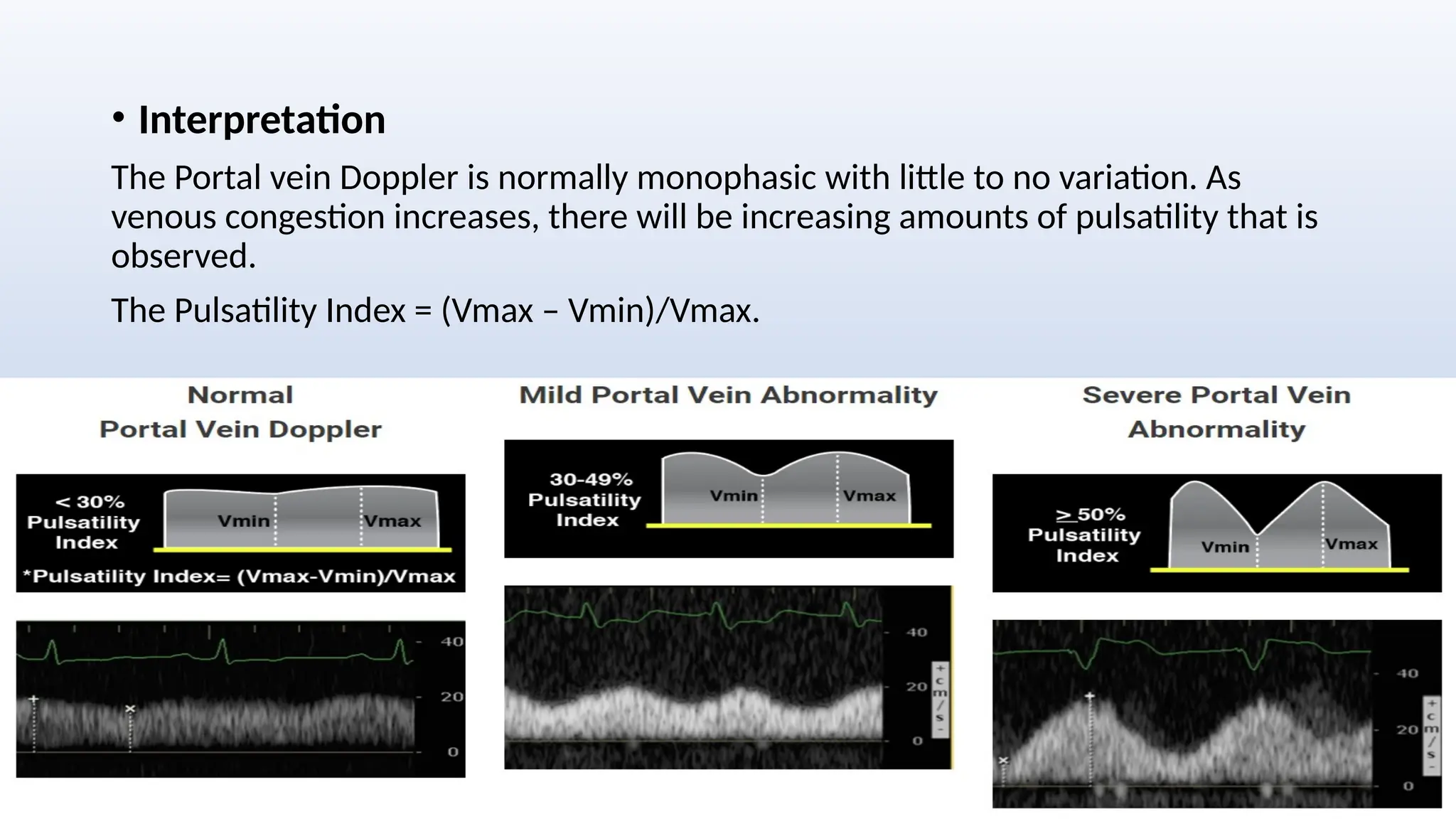 Venous Excess Ultrasound Score For venous congestion | PPTX