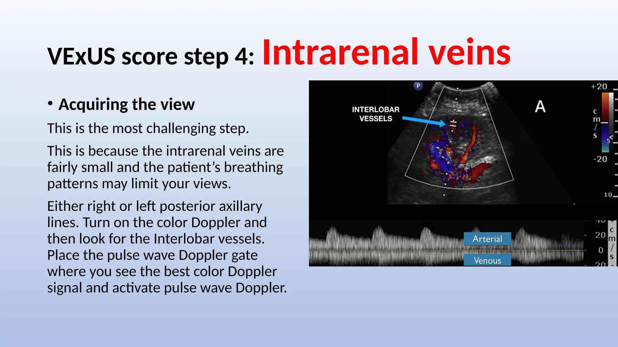 Venous Excess Ultrasound Score For venous congestion | PPTX
