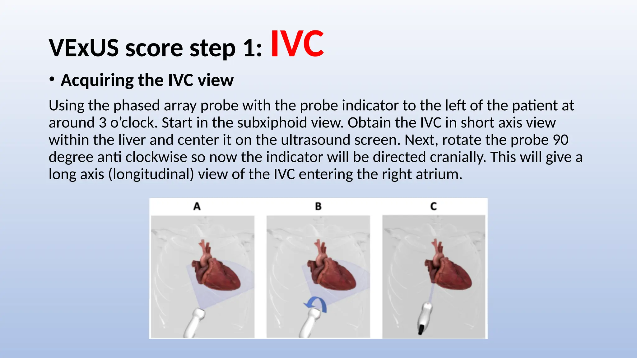 Venous Excess Ultrasound Score For venous congestion | PPTX