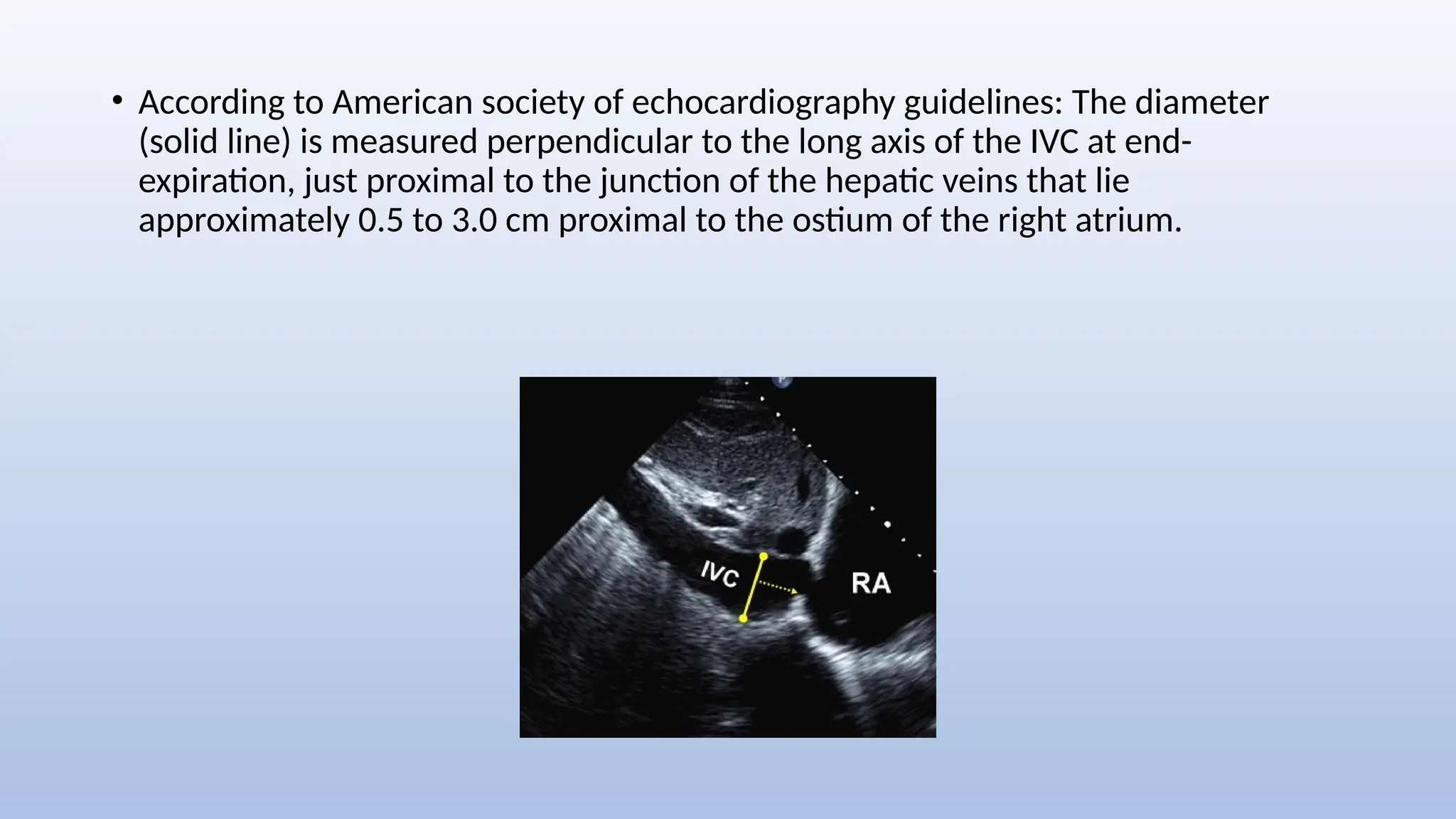 Venous Excess Ultrasound Score For venous congestion | PPTX