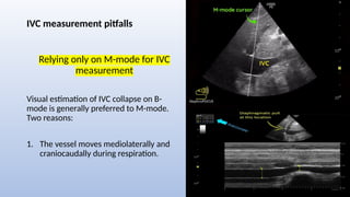 Venous Excess Ultrasound Score For venous congestion | PPTX