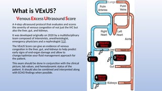 Venous Excess Ultrasound Score For venous congestion | PPTX