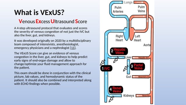 Venous Excess Ultrasound Score For venous congestion | PPTX | Heart and ...