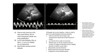 Sistema de Ultrasonido de Exceso Venoso (VExUS) | PDF