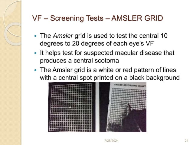 Visual field print out interpretation and analysis | PPTX | Eye and ...