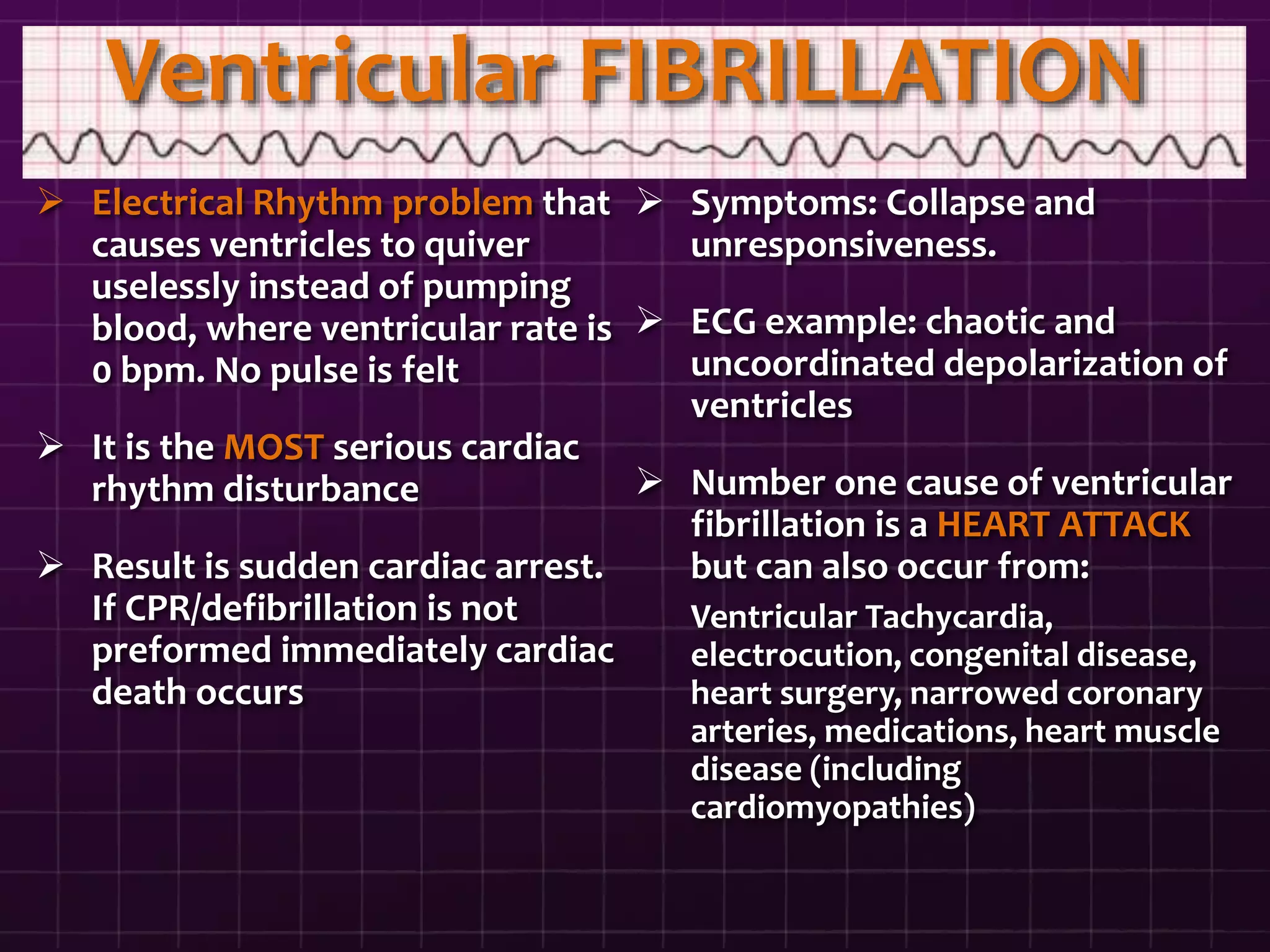Ventricular Tachycardia and Ventricular Fibrillation Presentation | PPTX
