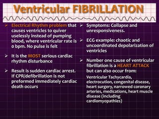 Ventricular Tachycardia and Ventricular Fibrillation Presentation | PPTX