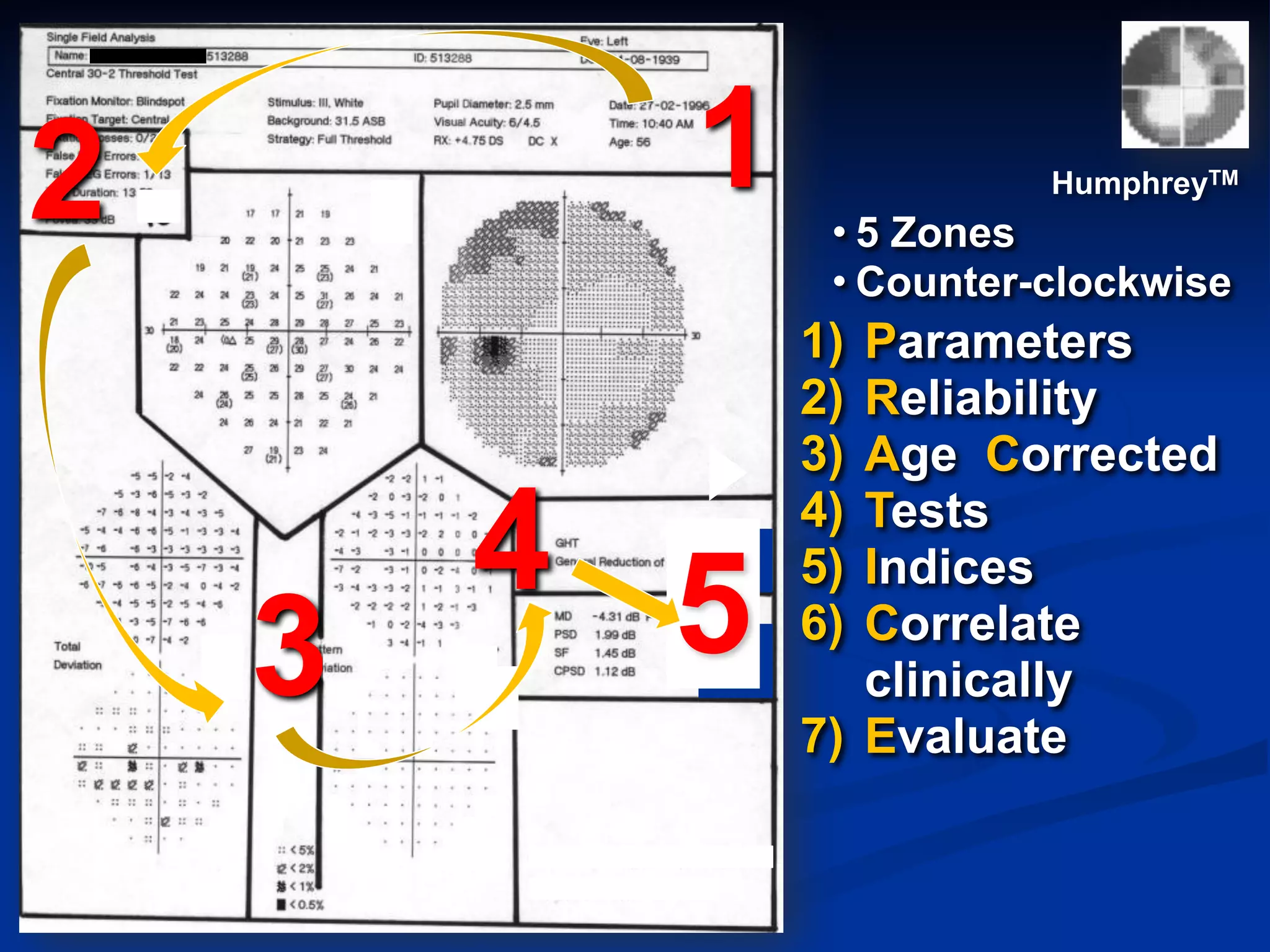 Visual Field in Glaucoma | PDF