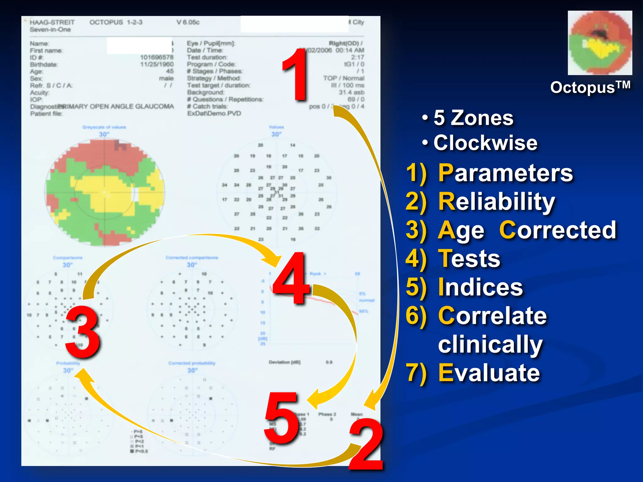 Visual Field in Glaucoma | PDF