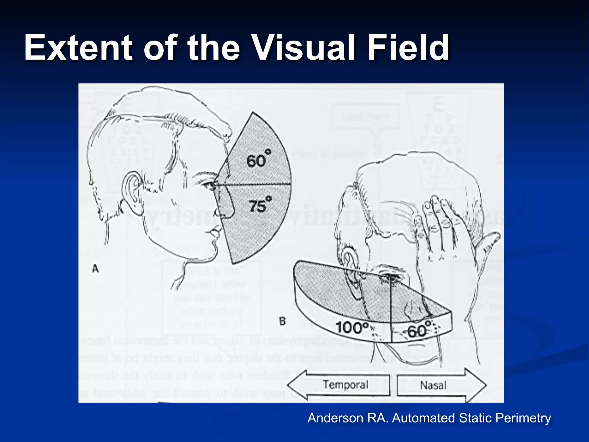 Visual Field in Glaucoma | PDF
