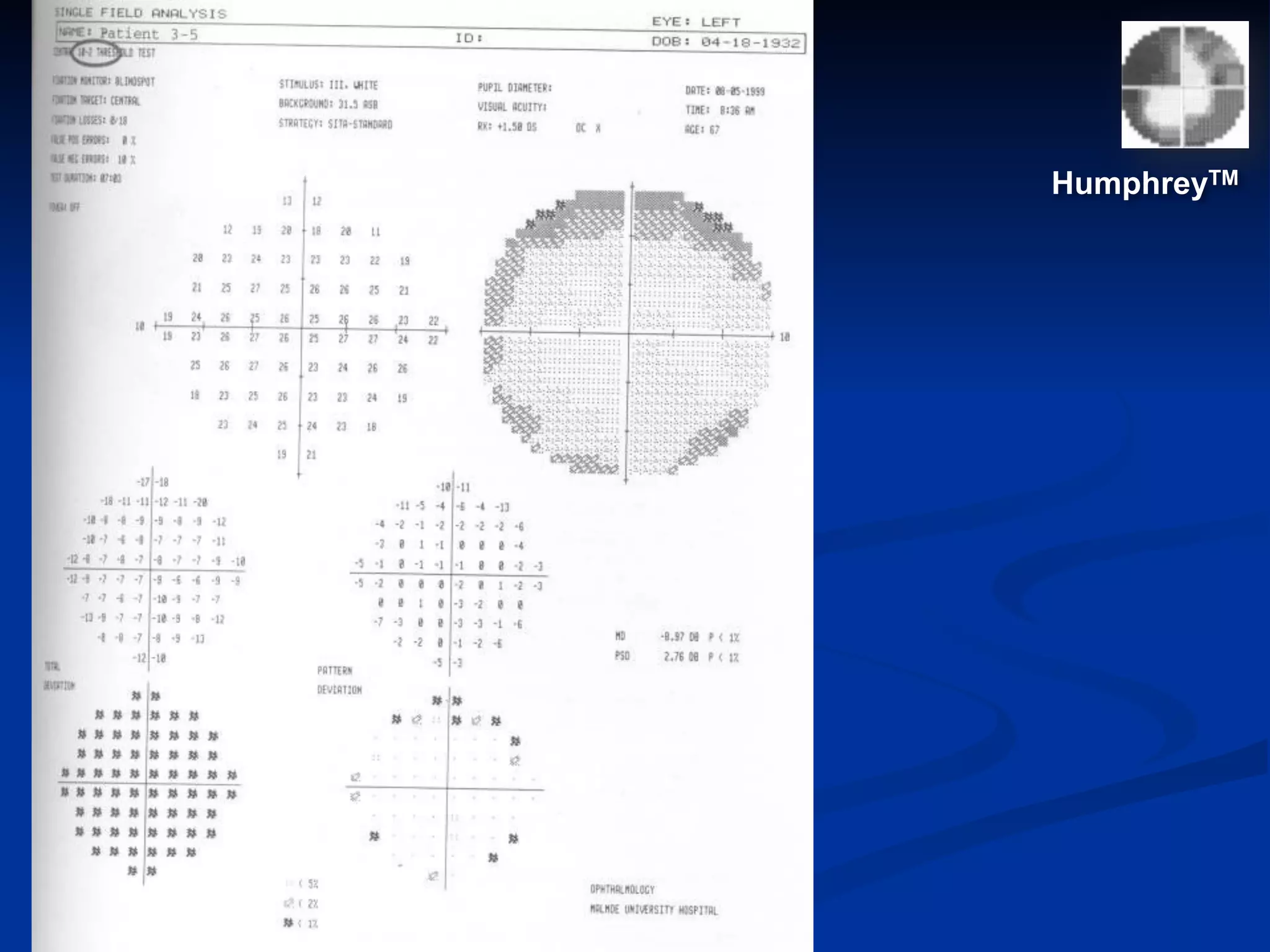 Visual Field in Glaucoma | PDF