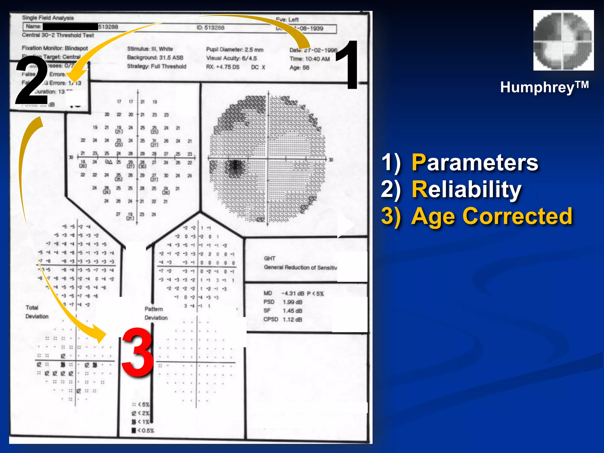 Visual Field in Glaucoma | PDF