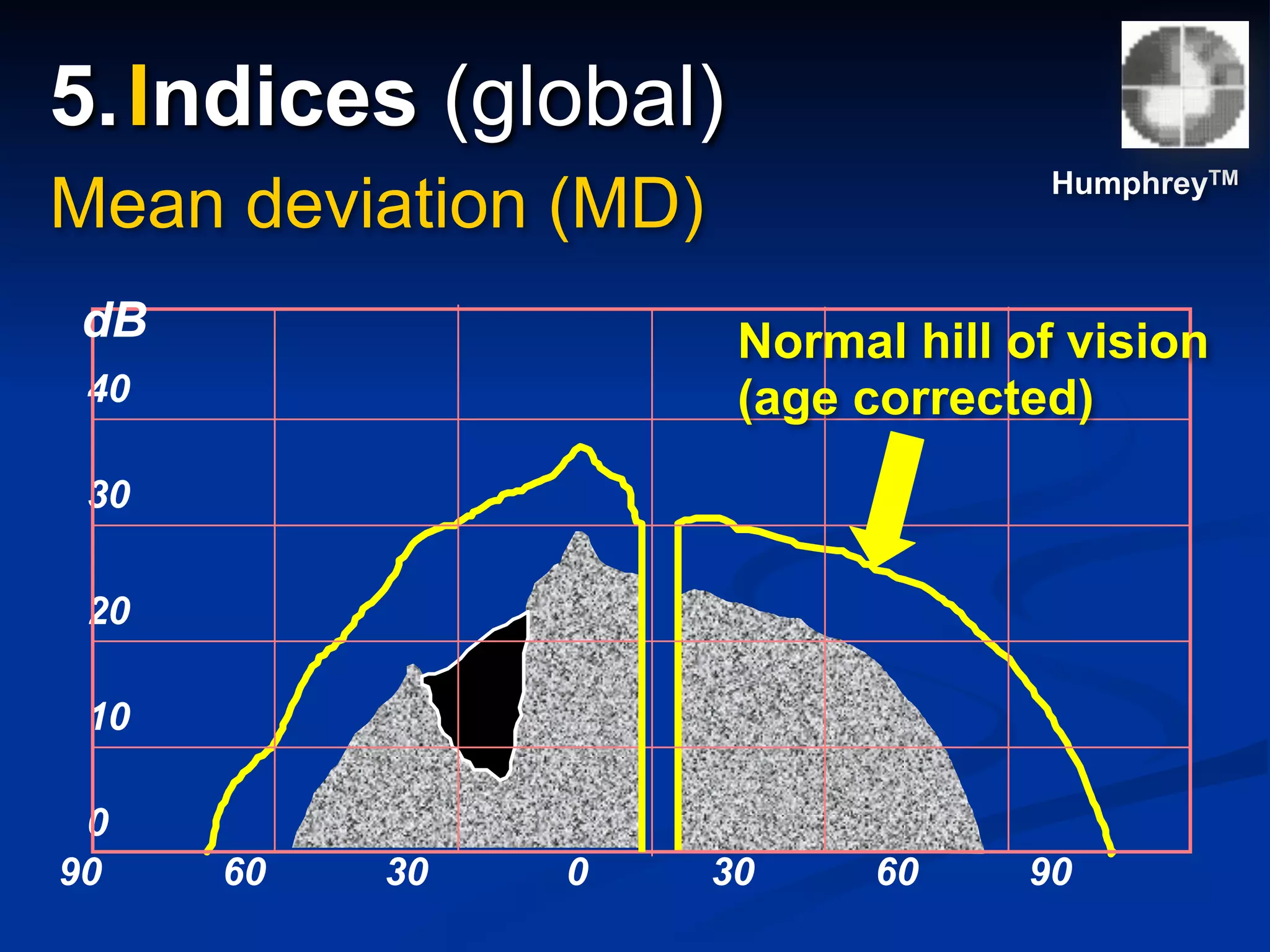 Visual Field in Glaucoma | PDF