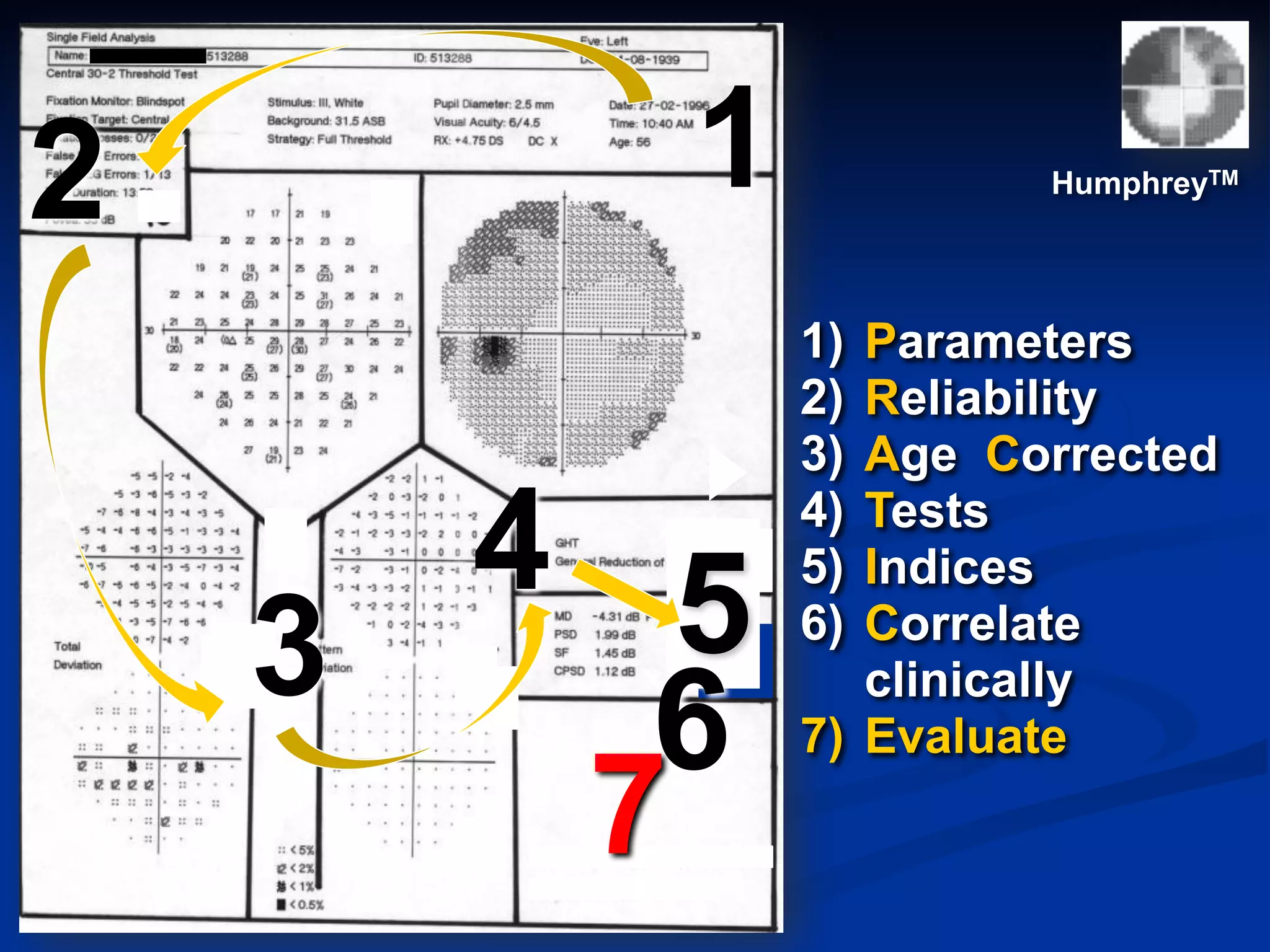 Visual Field in Glaucoma | PDF